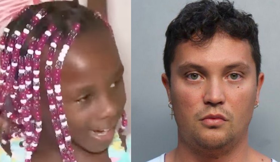 ‘he Slapped Me Florida Girl Bites Man Who Knocked Her Down And Tried To