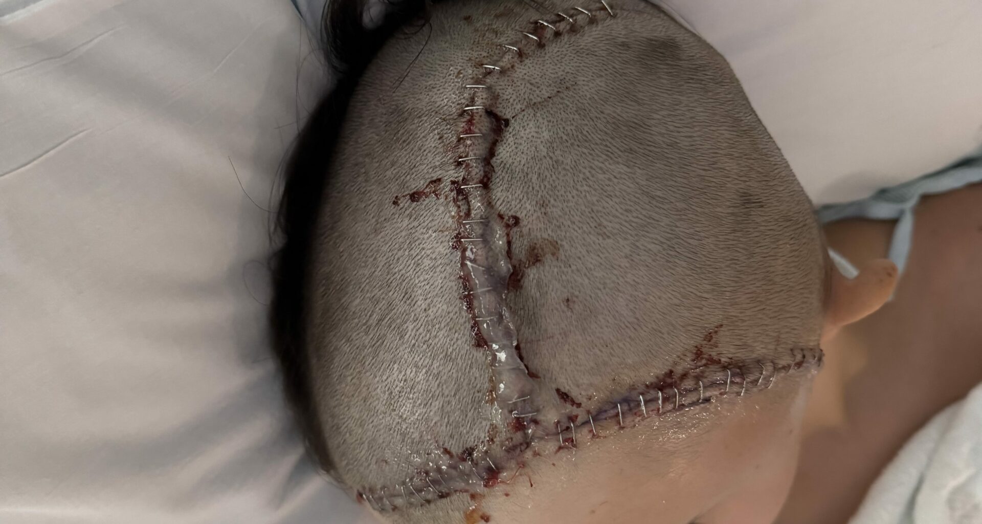 Kevin G Disability: What Illness Does The Tiktoker Have ...