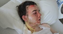 McDonald's Manager Suffers Burns in Shocking Hot Oil Assault Incident ...